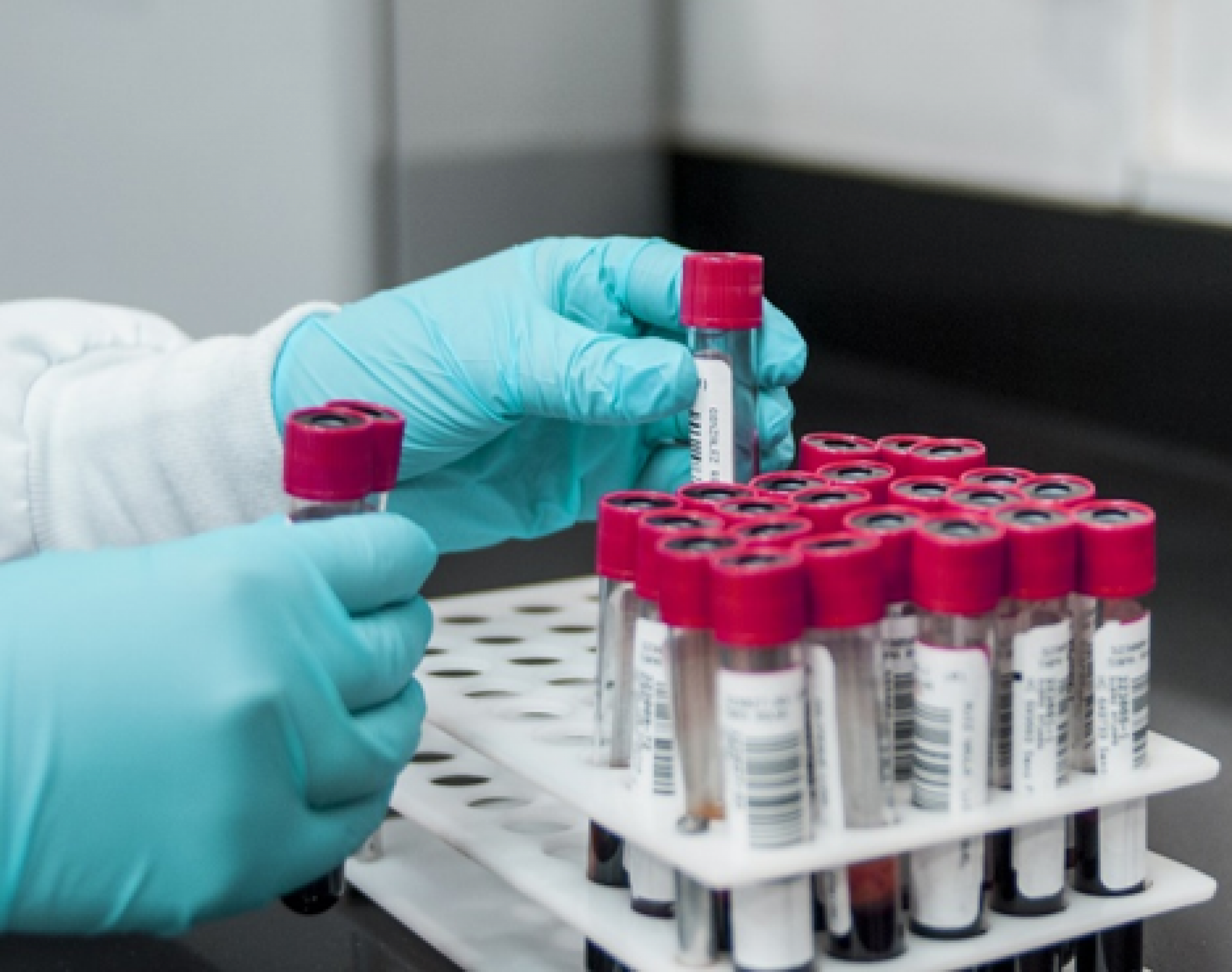 IVD Development - in.vent Diagnostica