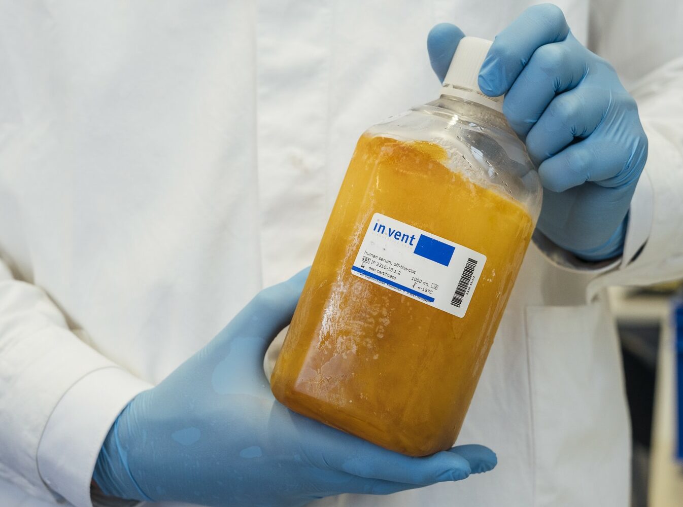 Normal Human Serum by invent - now available with special offer - in ...